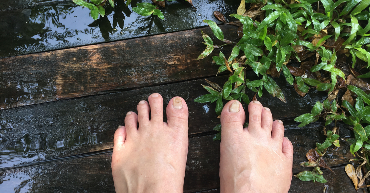 Musim Hujan, Waspada Leptospirosis - WeCare.id Musim Hujan, Waspada Leptospirosis - WeCare.id